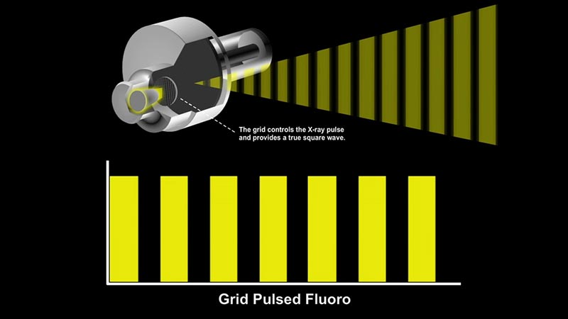 Canon Infinix-i Core ангиографическая система